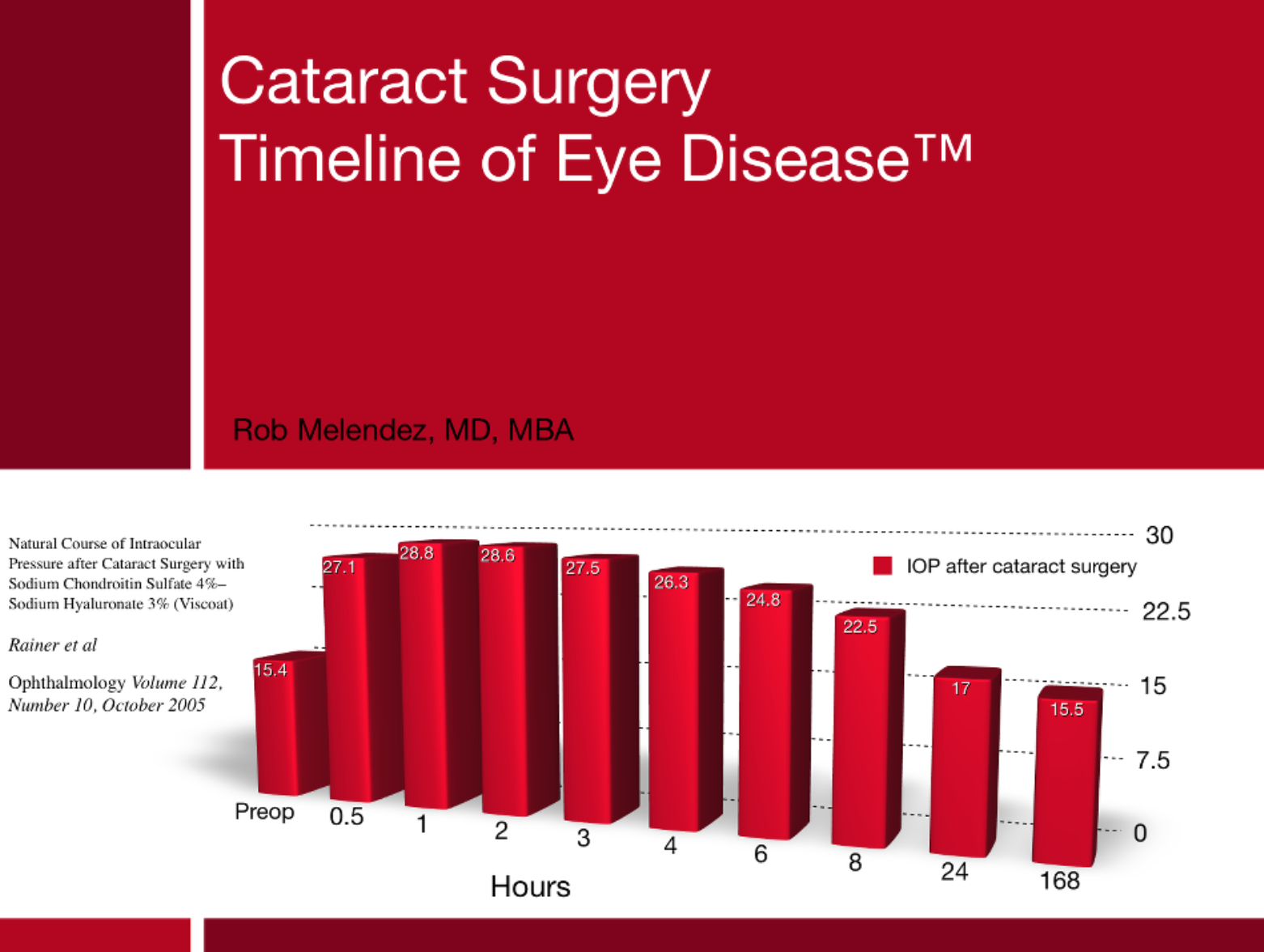 Cataract Surgery – Robert F. Melendez, MD